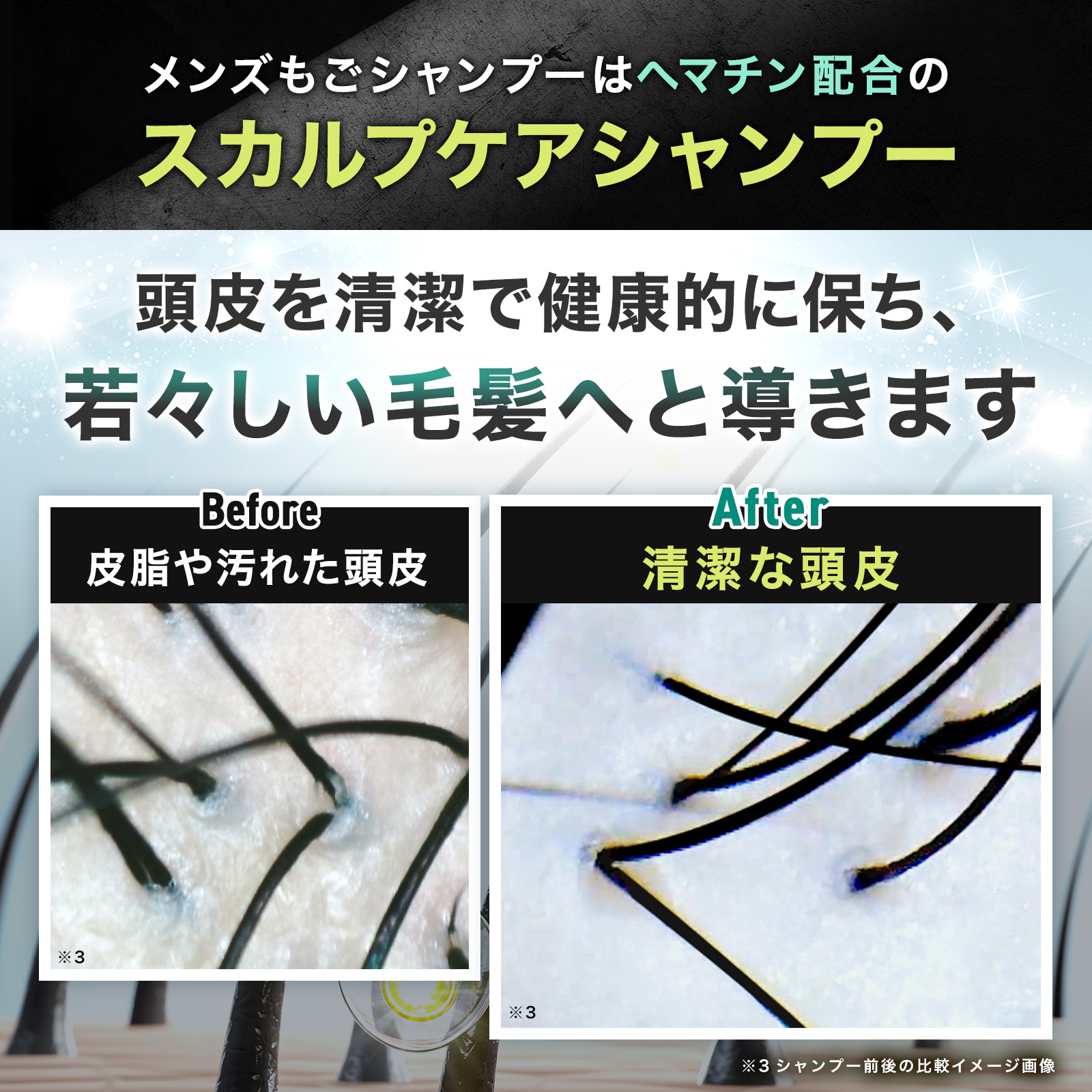 スカルプシャンプー メンズもごシャンプー 1000ml メンズシャンプー